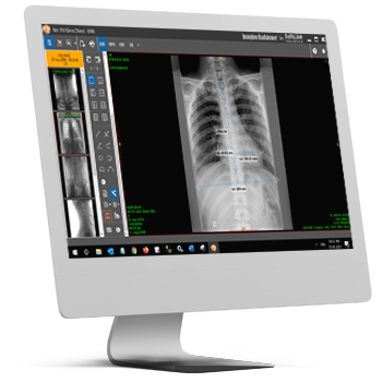 Radiology Solution – SoftLink International